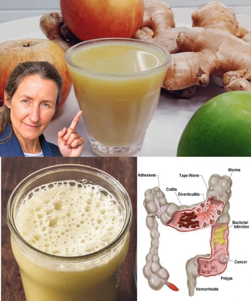 Colon Cleanse: The 3-Ingredient Juice That Flushes Pounds of Toxins ...