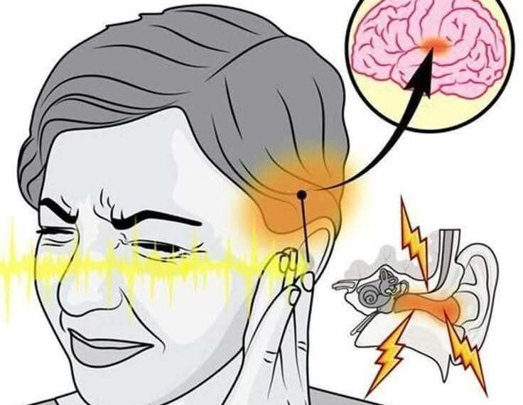 Ringing in the Ear: What Your Body May Be Trying to Tell You – All Recipes